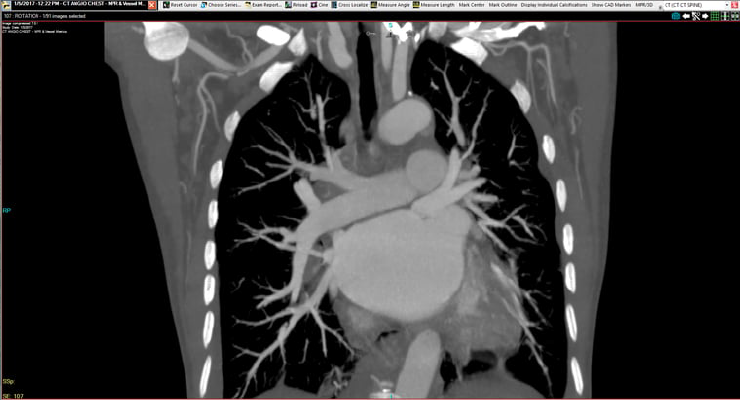 Cardiology PACS for Cardiac Motion Imaging - NovaCardio | Novarad