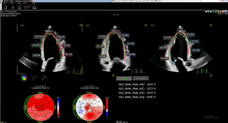 Cardiology PACS for Cardiac Motion Imaging - NovaCardio | Novarad
