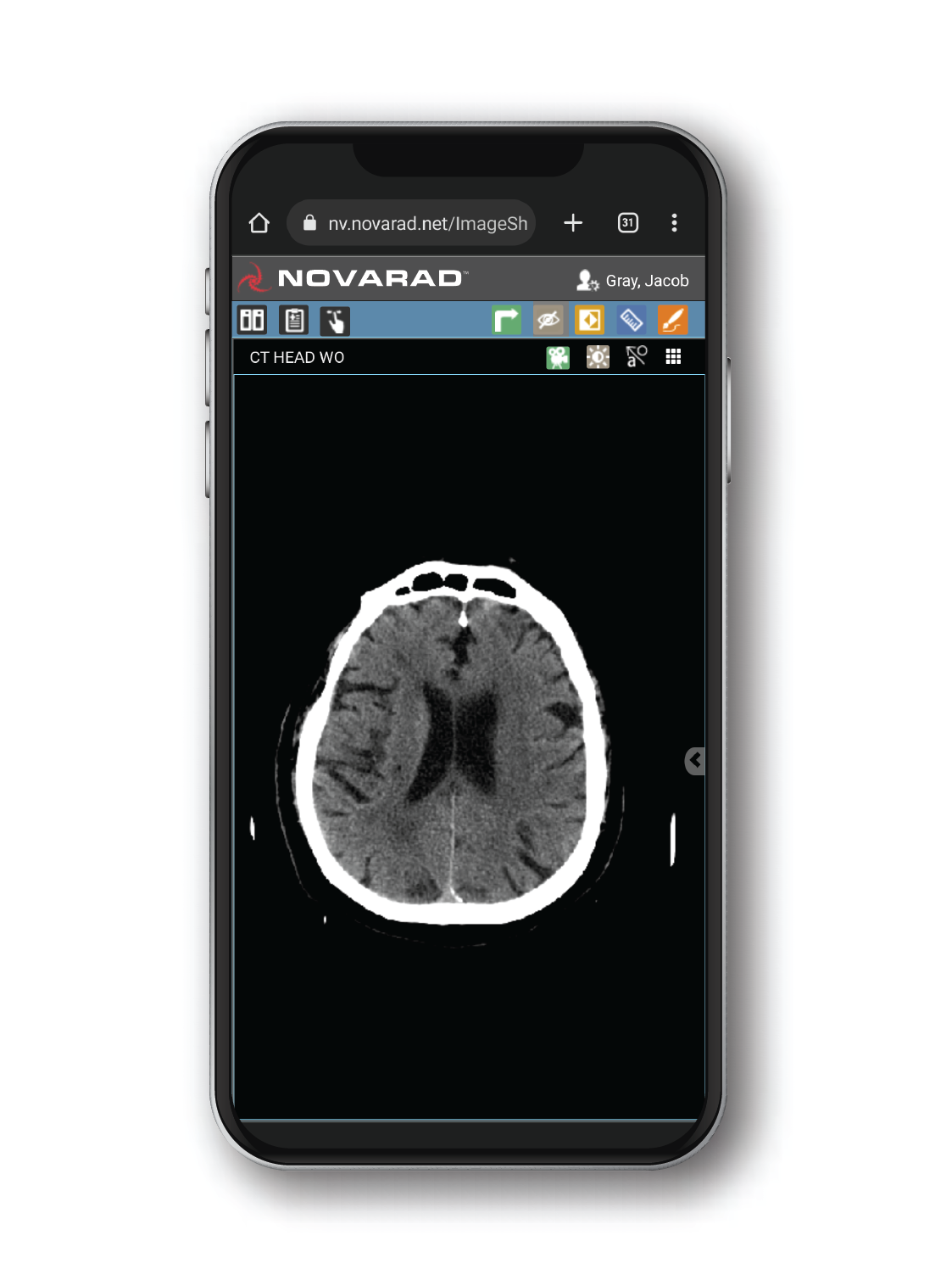 CryptoChart - Cloud Based Medical Image Sharing | Novarad