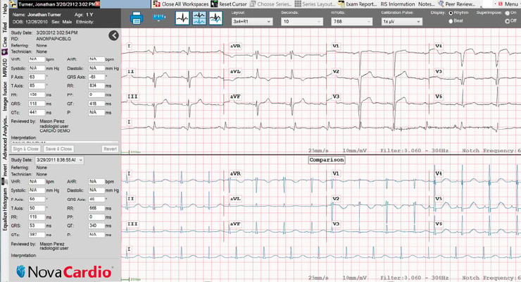 Cardiology PACS for Cardiac Motion Imaging - NovaCardio | Novarad