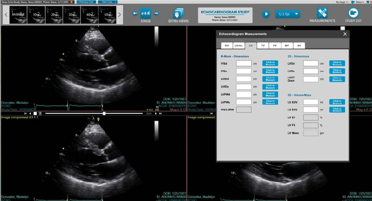 Cardiology PACS for Cardiac Motion Imaging - NovaCardio | Novarad