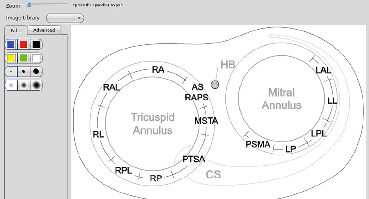 Cardiology PACS for Cardiac Motion Imaging - NovaCardio | Novarad