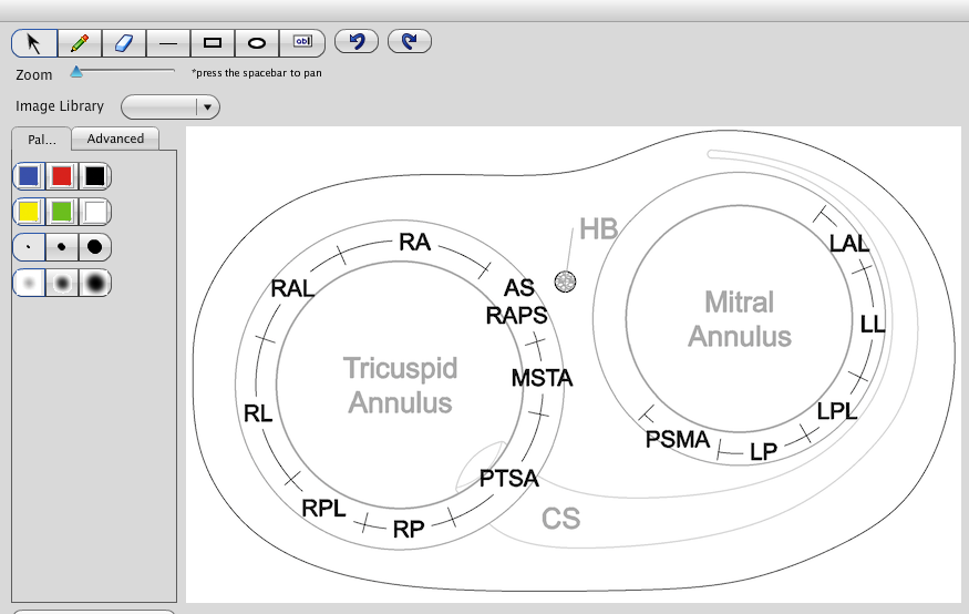 NovaCardio - Cardiac Motion Imaging CPACS Solution | Novarad