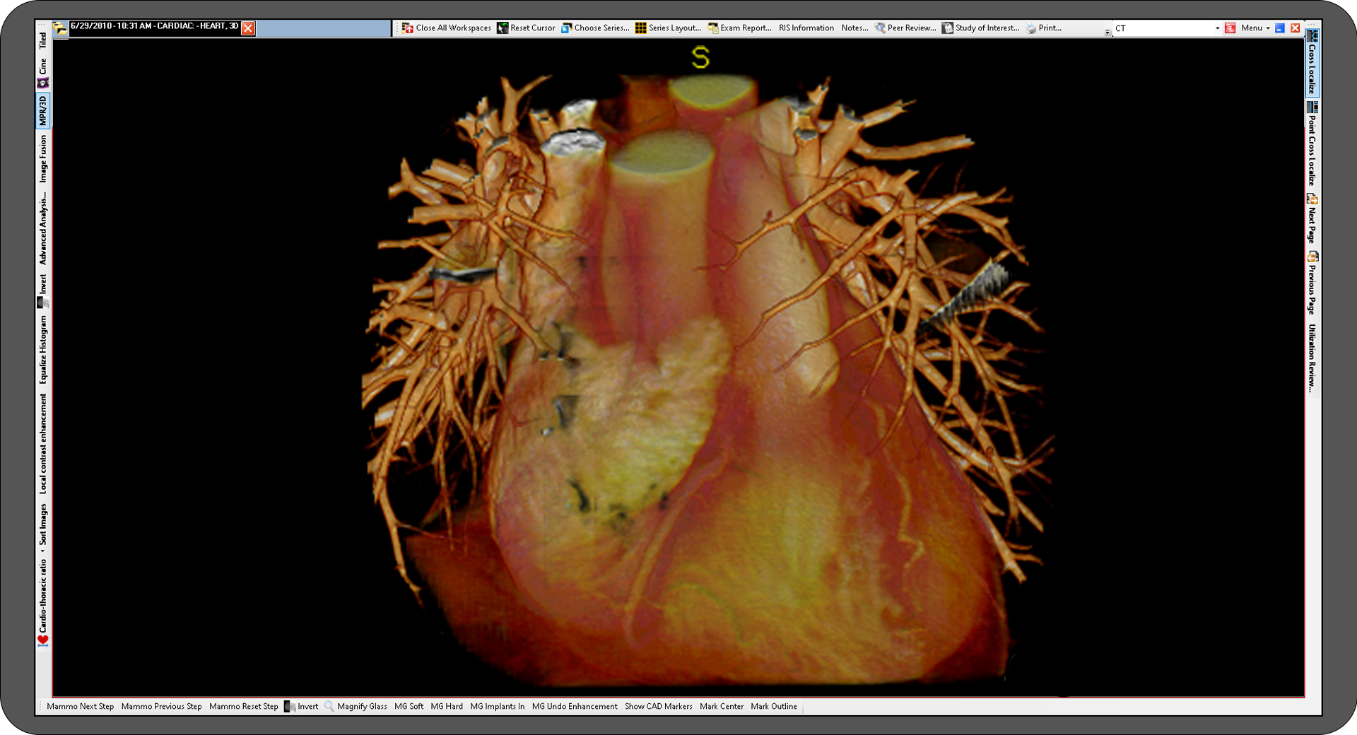 PACS System with Enterprise Imaging - NovaPACS EI | Novarad