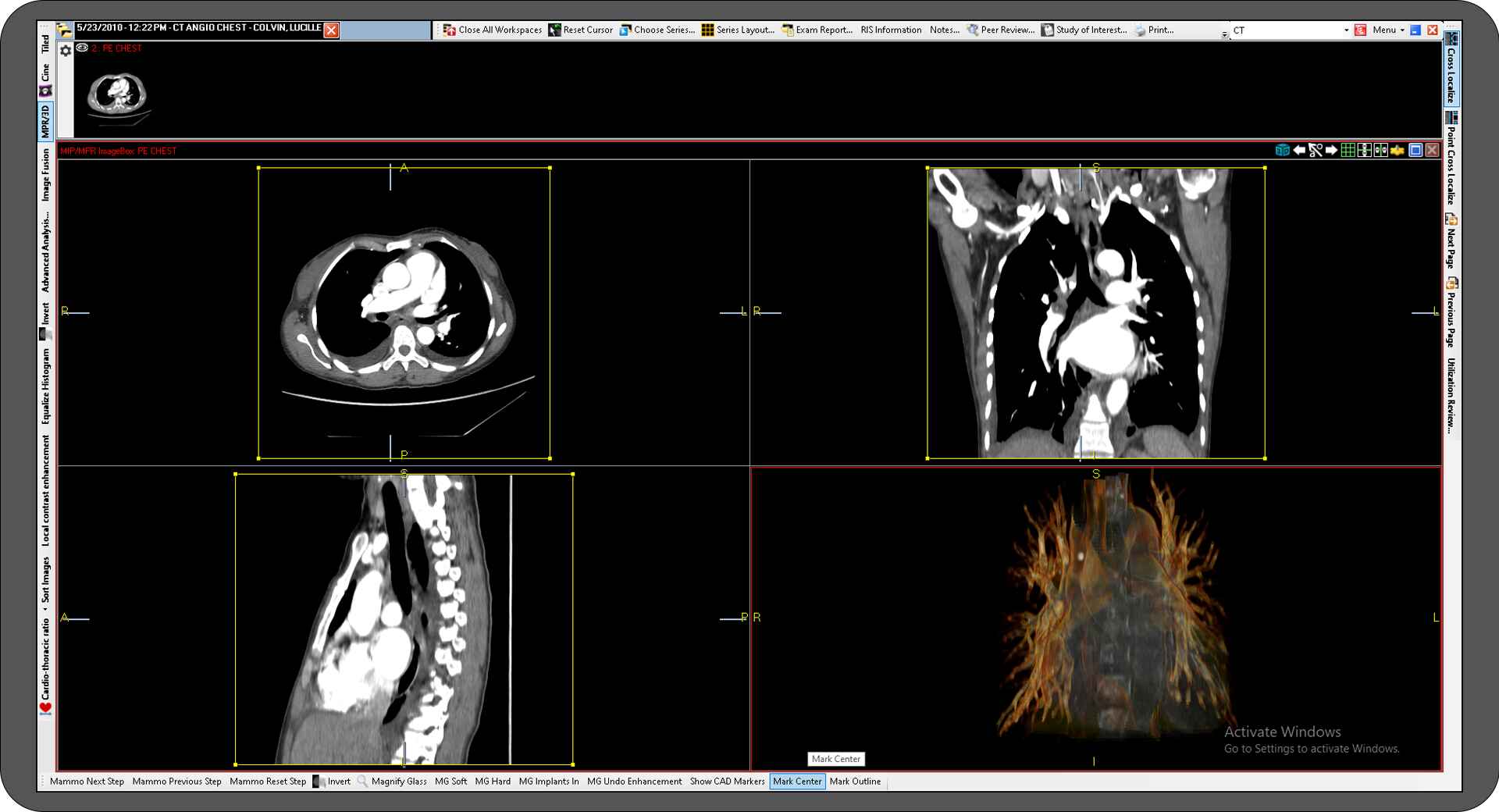 PACS System with Enterprise Imaging - NovaPACS EI | Novarad