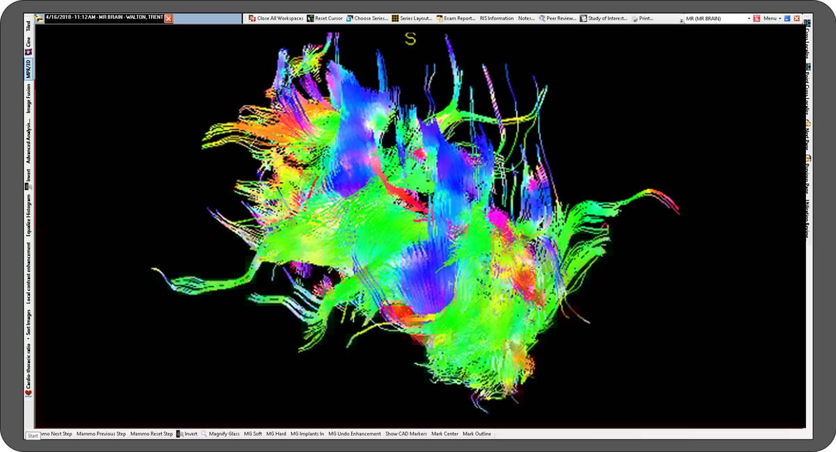 PACS System with Enterprise Imaging - NovaPACS EI | Novarad