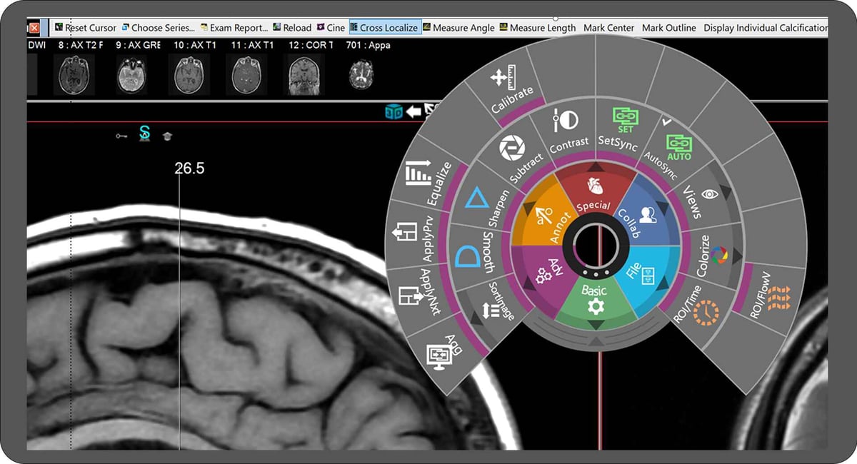 PACS System with Enterprise Imaging - NovaPACS EI | Novarad