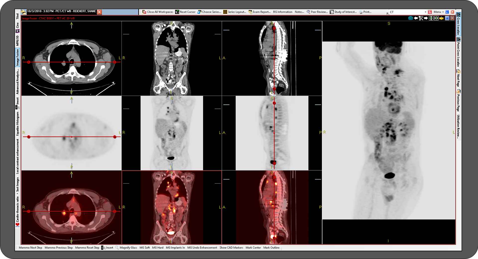 PACS System with Enterprise Imaging - NovaPACS EI | Novarad