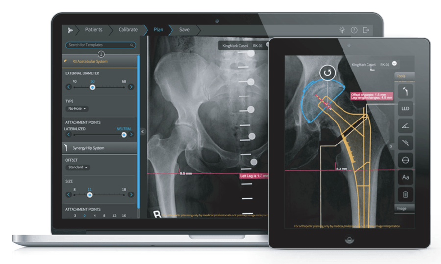 NovaOrtho - Complete Orthopedic PACS System | Novarad