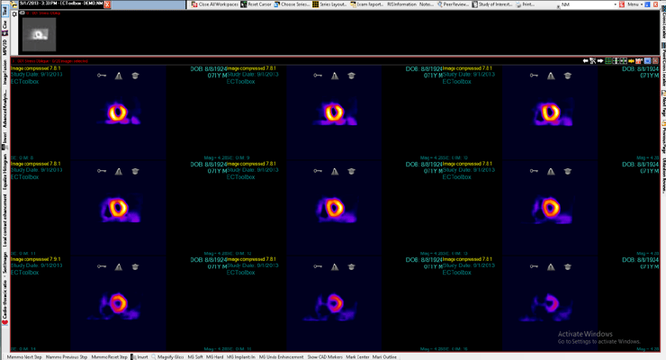 Cardiology PACS for Cardiac Motion Imaging - NovaCardio | Novarad