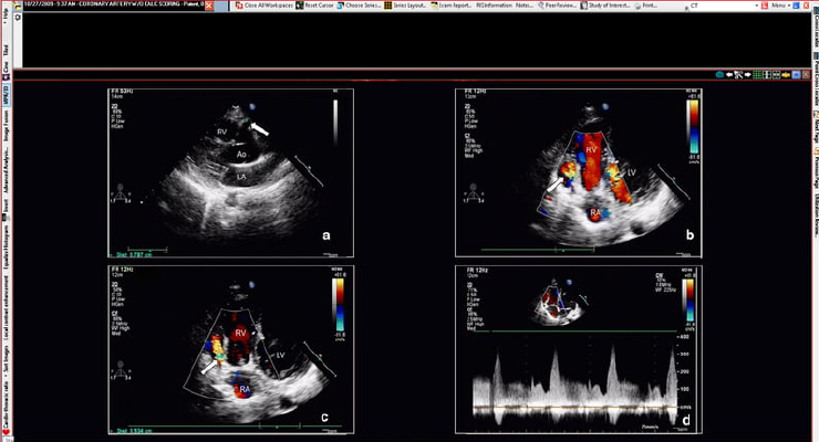 Cardiology PACS for Cardiac Motion Imaging - NovaCardio | Novarad