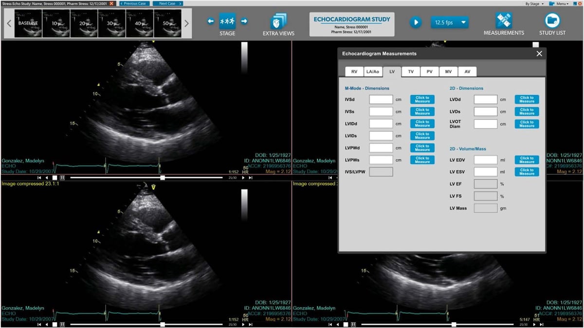 NovaCardio - Cardiac Motion Imaging CPACS Solution | Novarad