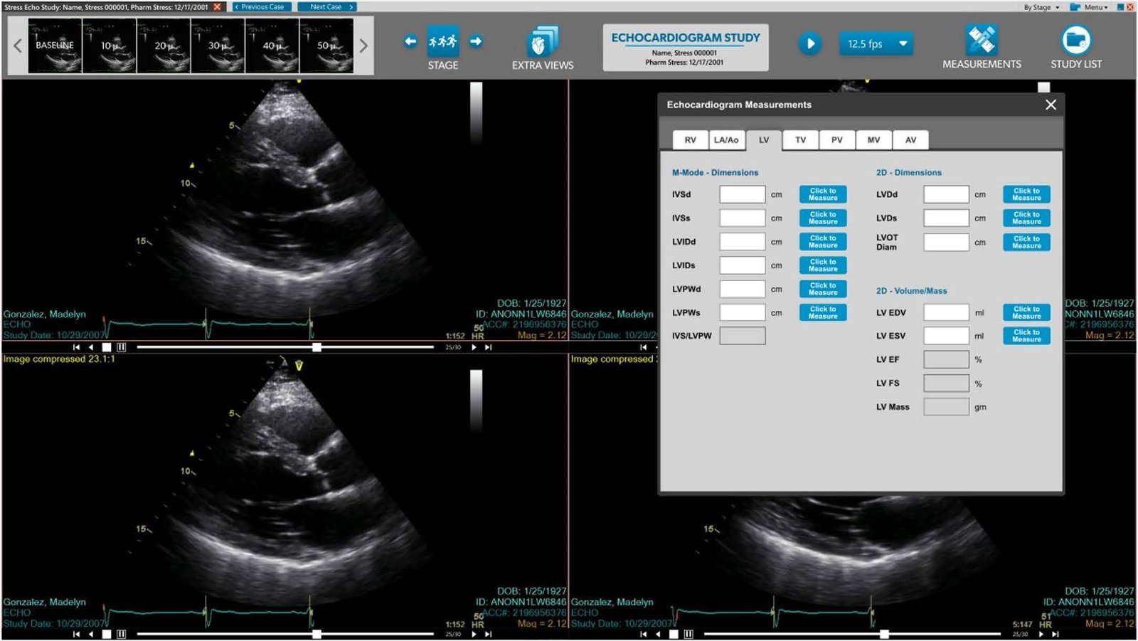 NovaCardio - Cardiac Motion Imaging CPACS Solution | Novarad