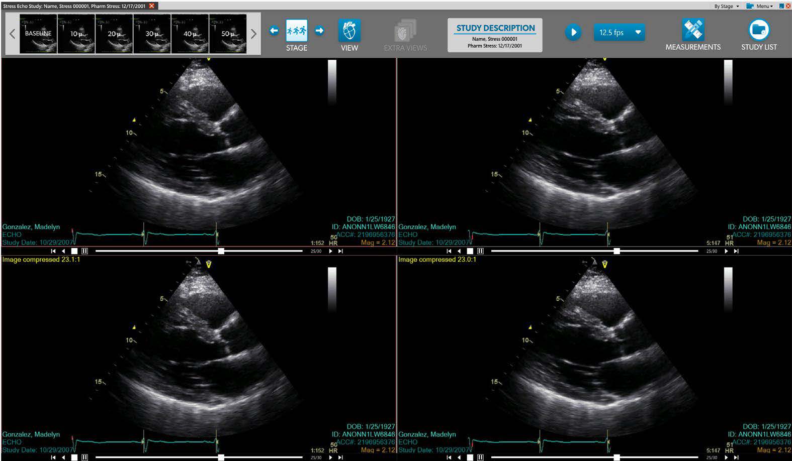 NovaCardio - Cardiac Motion Imaging CPACS Solution | Novarad