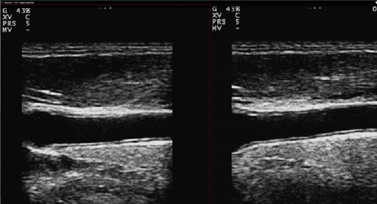 Cardiology PACS for Cardiac Motion Imaging - NovaCardio | Novarad