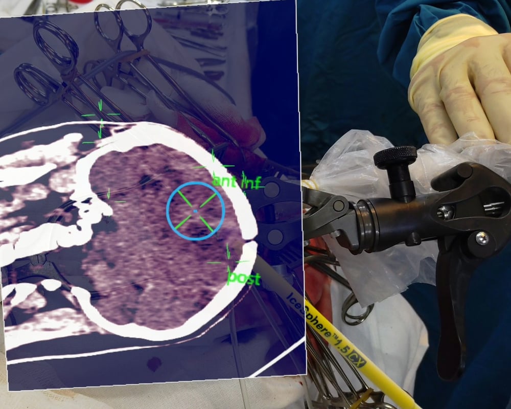 VisAR: Augmented Reality Surgical Navigation | Novarad