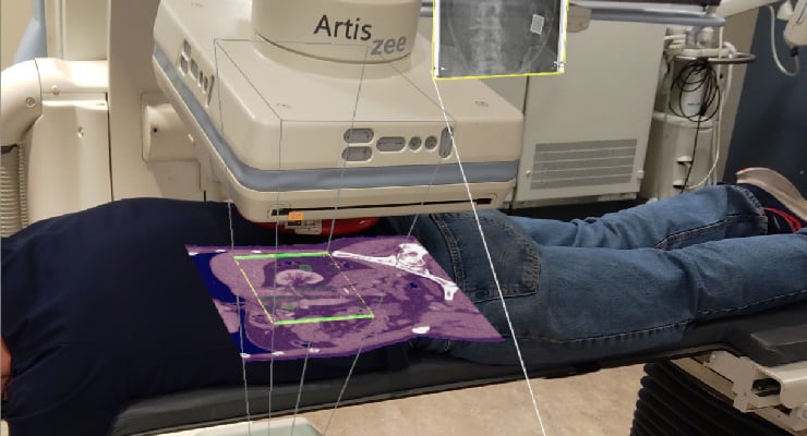 VisAR: Augmented Reality Surgical Navigation | Novarad