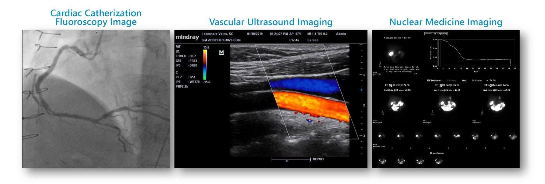 NovaCardio - Cardiac Motion Imaging CPACS Solution | Novarad