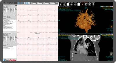 NovaCardio - Cardiac Motion Imaging CPACS Solution | Novarad
