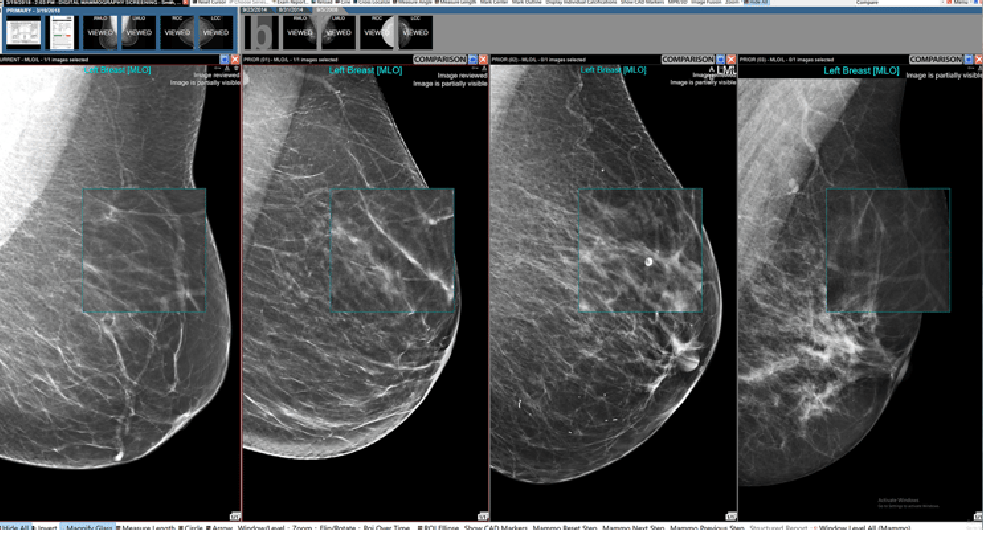 NovaMG PRO Breast Imaging Solution from Novarad