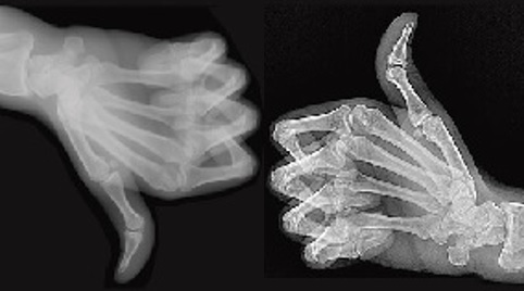 Medical Imaging Newsroom | Novarad Enterprise Healthcare Solutions